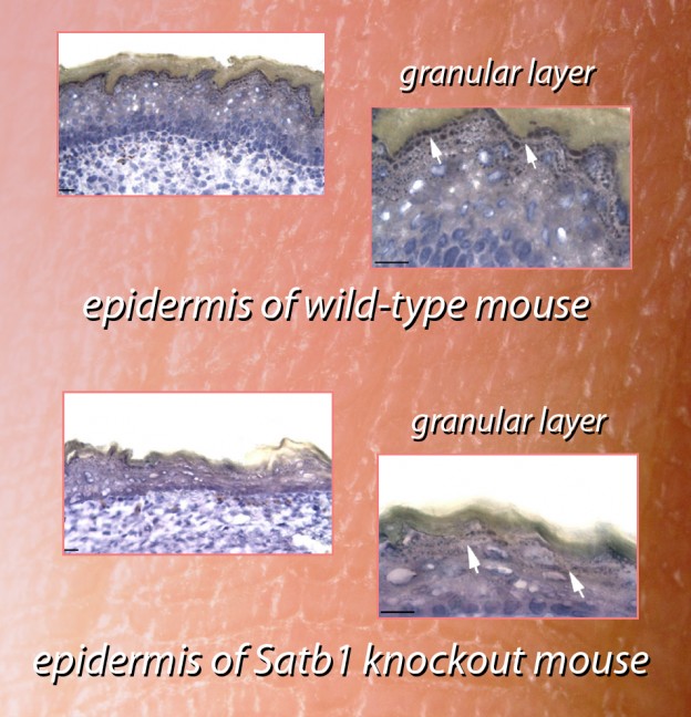 How Key Genes Cooperate to Make Healthy Skin - Berkeley Lab – Berkeley ...